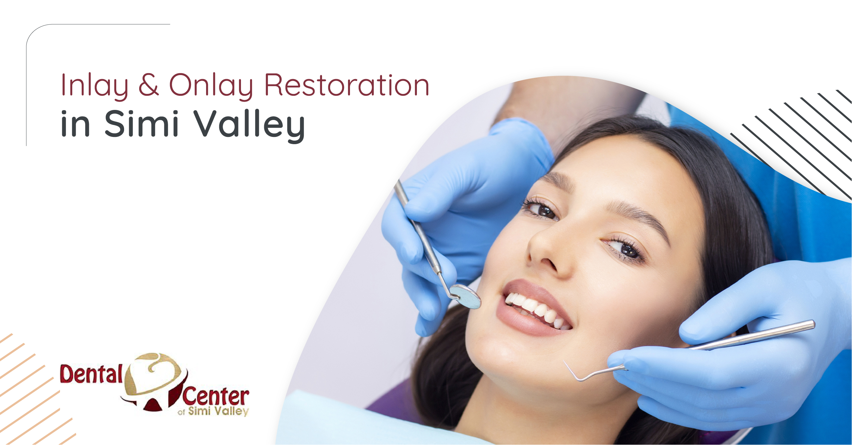 Inlay & Onlay Restoration in Simi Valley